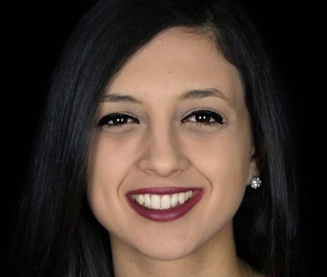 Ala Hamdan - Canary Mission